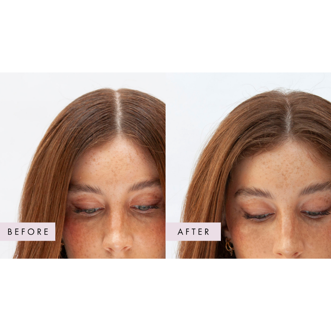 Peptide Puff™ Dry Shampoo - Hair Gain Now